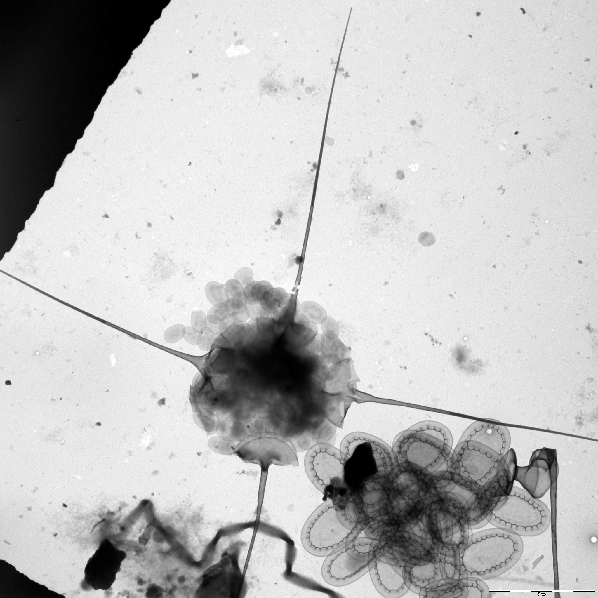 Spiniferomonas bourrellyi | Silica-scaled chrysophytes of Europe